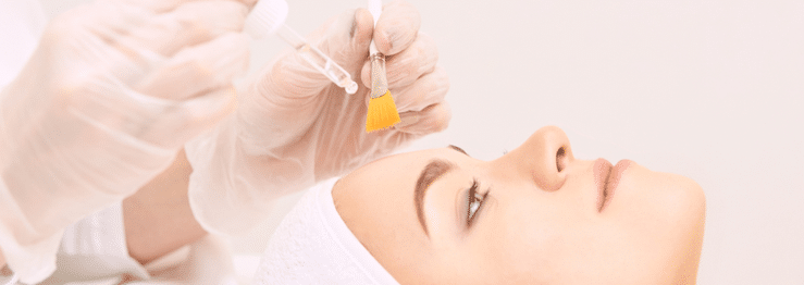 Sobre o Peeling de Fenol – Dra. Carolina Marçon